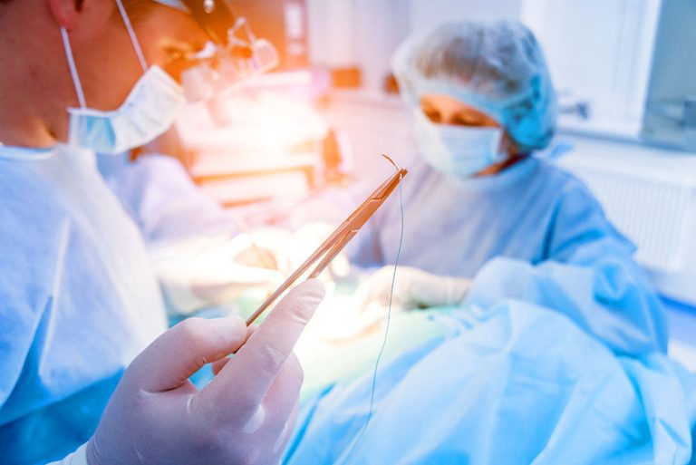 Are There Non-Surgical Options? Exploring Alternatives to Surgery ...