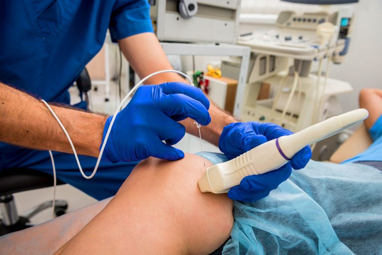 Radiofrequency Ablation: Regenespine